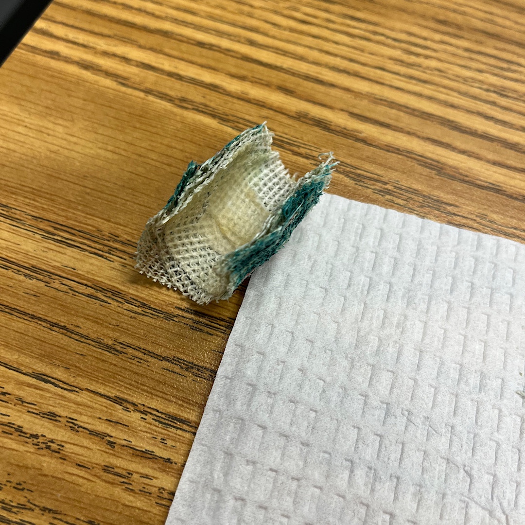 Free the Finger! Cast-free after 9 weeks | Angel Ackerman